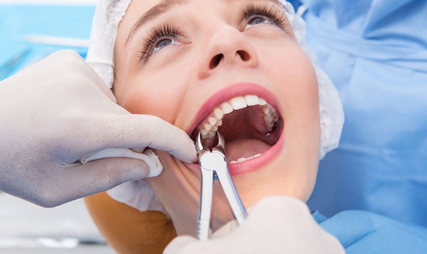 Can You Get a Tooth Extraction and Implant at the Same Time?