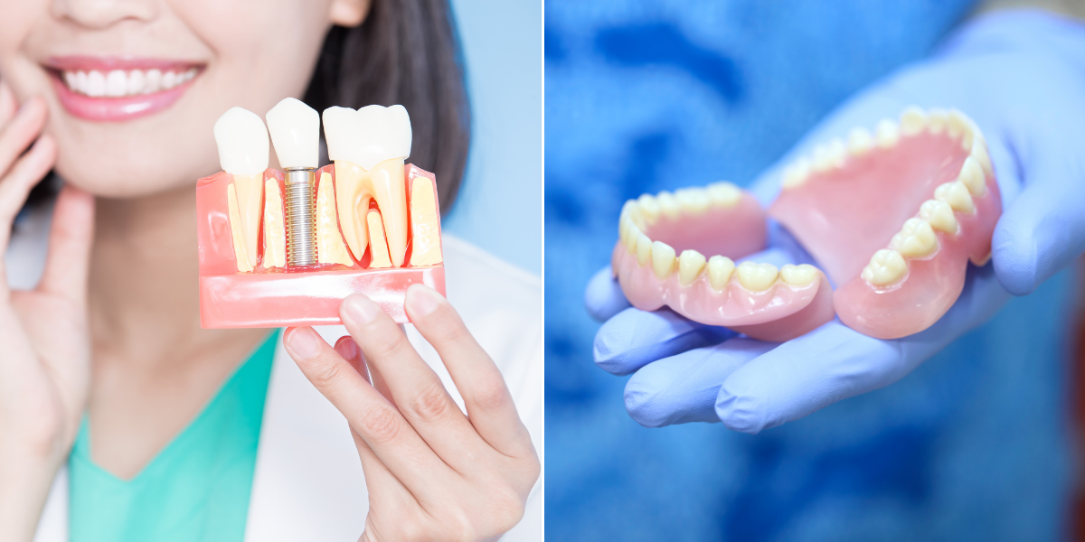 Dental Implants vs. Dentures: What You Need to Know