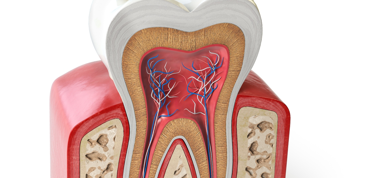 Root Canal Therapy: Stop Tooth Infections & Avoid Extraction